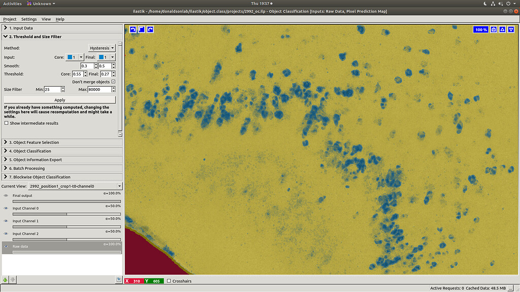 Density counting of neurons - Image Analysis - Image.sc Forum