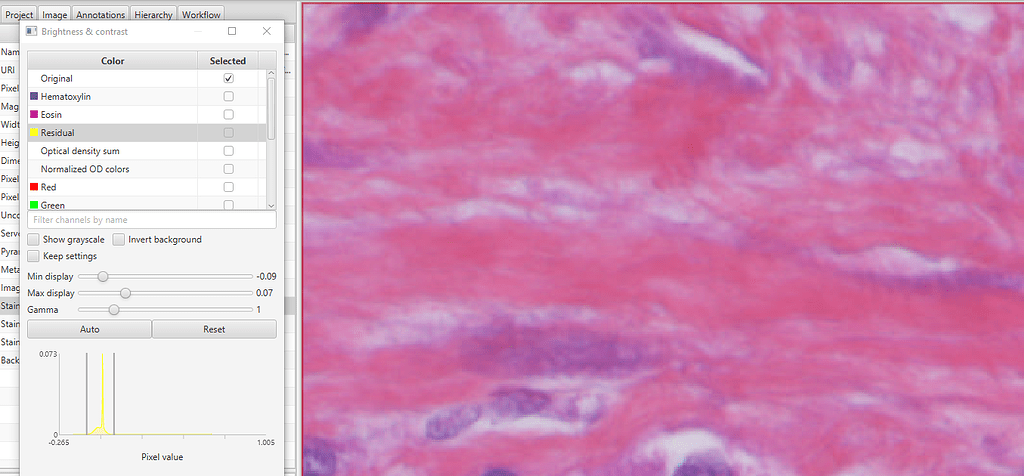 Saffron staining analysis with quPath (histology tissues) - Usage & Issues - Image.sc Forum