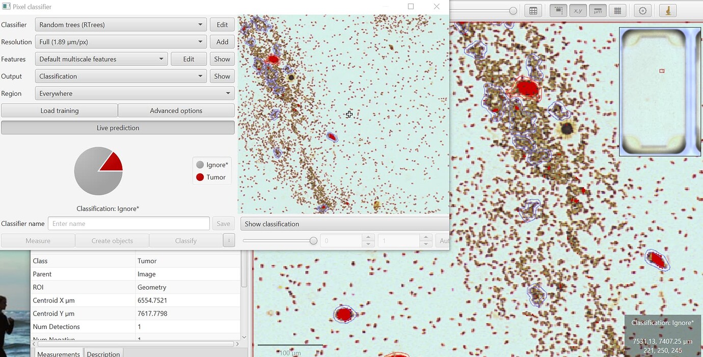QuPath Using an object classifier on detections from a pixel classifier - Usage & Issues - Image ...