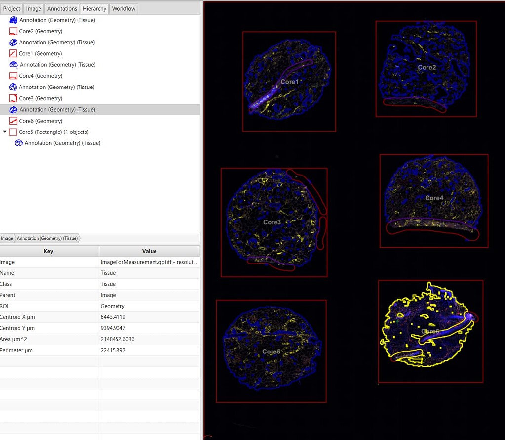 QuPath Resolve Hierarchy Geometry Annotation type - Image Analysis - Image.sc Forum