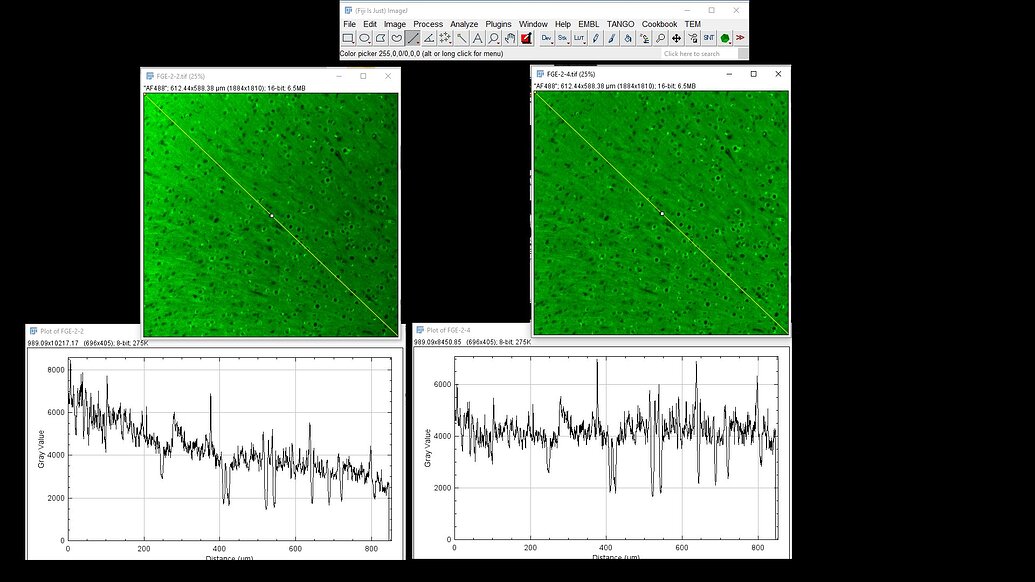 Illumination Correction Of Fluorescence Image Using The Basic Plugin In