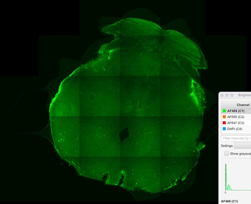 Does deepslice work well with partial slices? - Image Analysis - Image.sc Forum