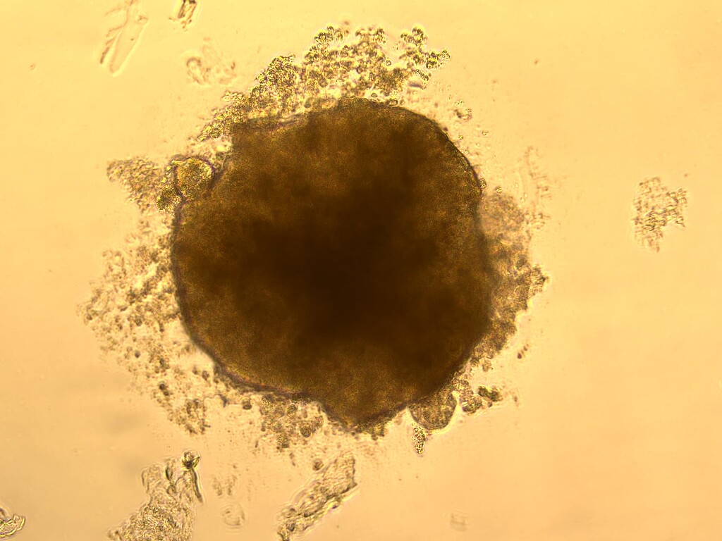 Pipeline to segment organoid live imaging - Image Analysis - Image.sc Forum