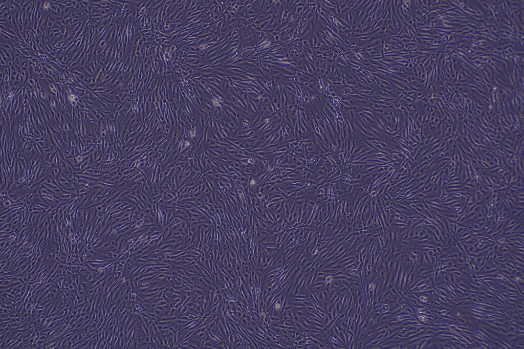 How can I calculate the cell conflict rate (area ratio of cells on the screen) and segmentation ...