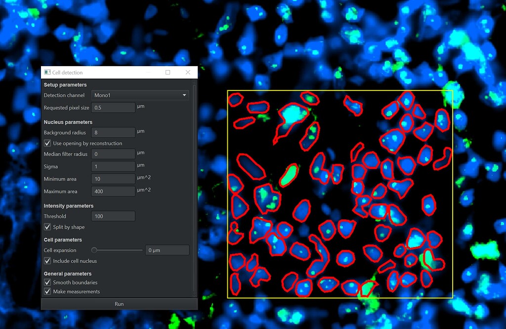 Fluorescence Spot detection problem - Image Analysis - Image.sc Forum