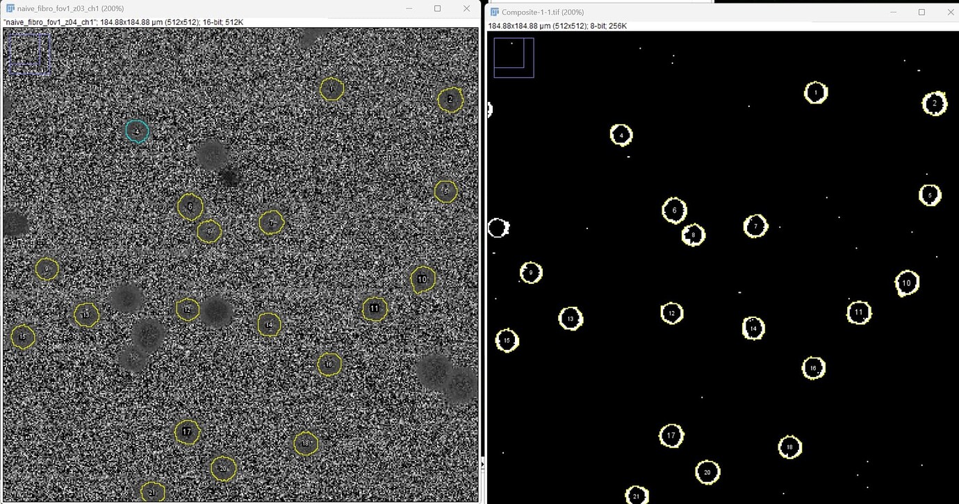 Using analyze particles excluding holes in a non-binary image - Image Analysis - Image.sc Forum
