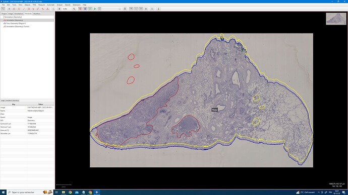 Remove an annotation from hierarchy - Image Analysis - Image.sc Forum