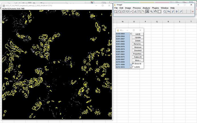 Analyze particles within ROI in ImageJ - Image Analysis - Image.sc Forum