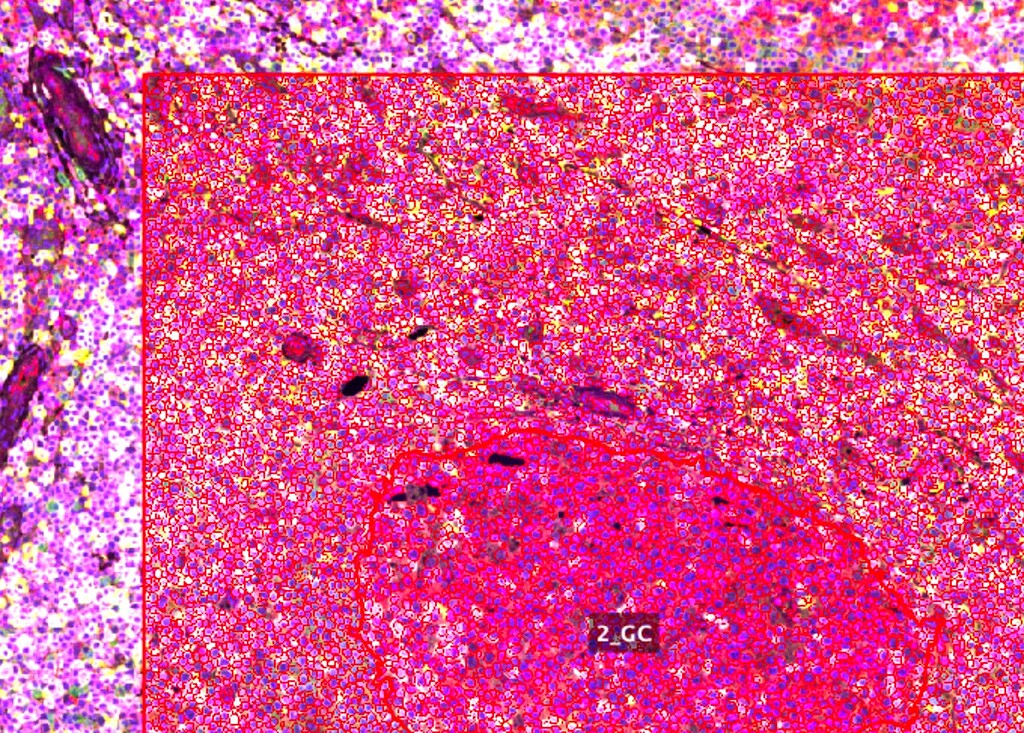 How to indicate which segmented cell detections belong to a given annotation within ROI in the ...