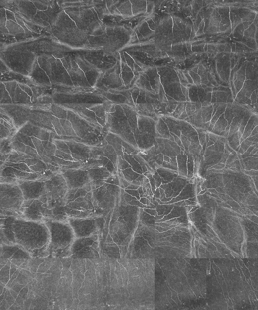 Directionality vs Orientation J with Dominant direction - Image ...