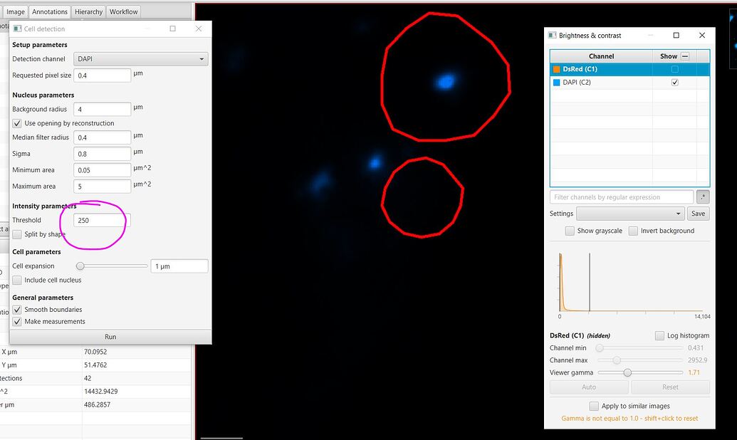 Cell detection issues in Qupath - Image Analysis - Image.sc Forum