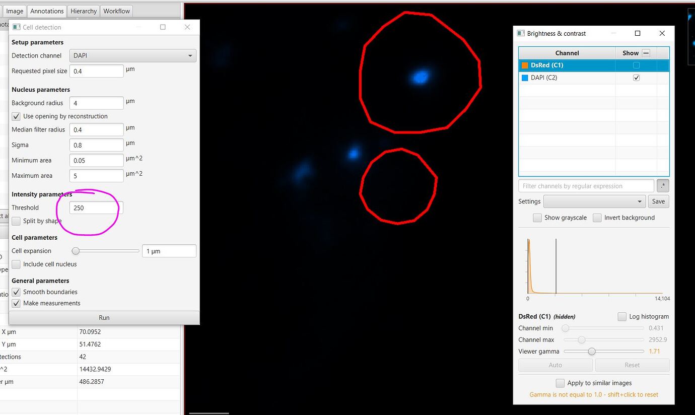 Cell detection issues in Qupath - Image Analysis - Image.sc Forum
