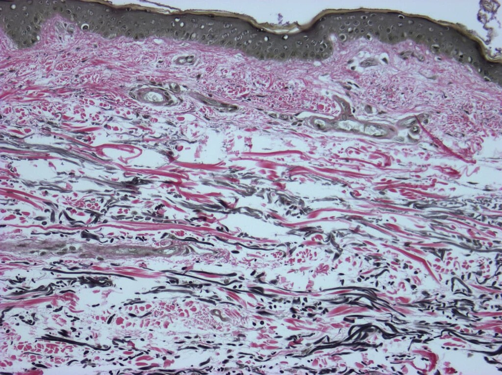 Requesting help quantifying VVG stain - Image Analysis - Image.sc Forum