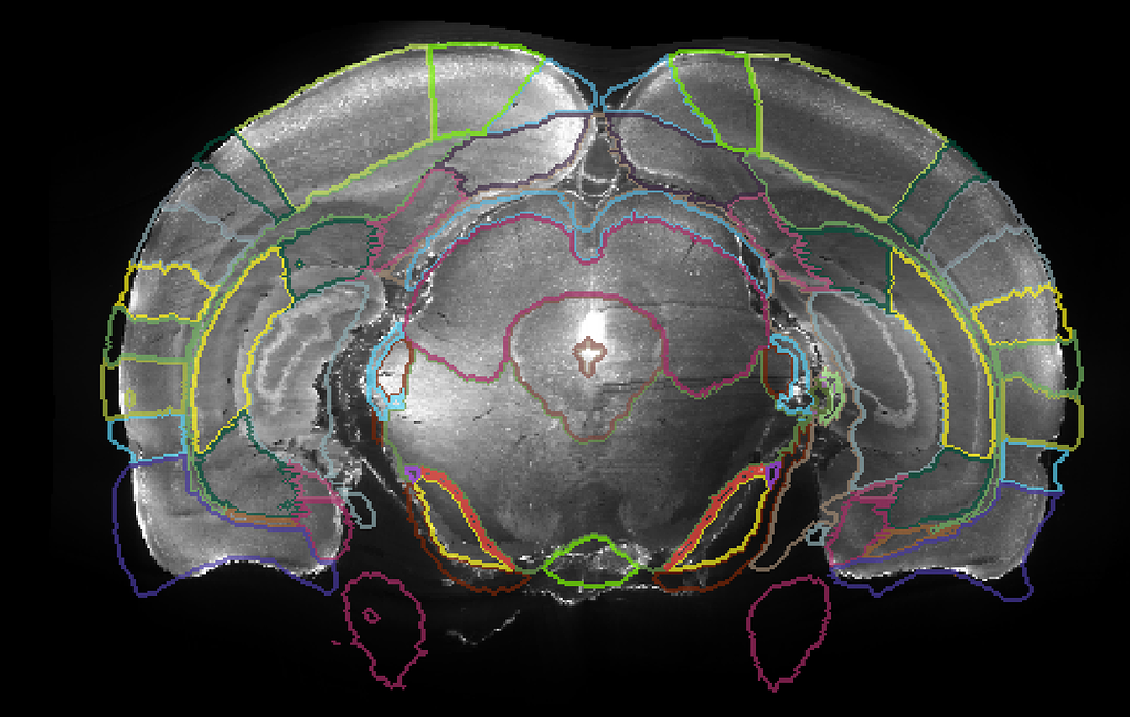 Optimizing a BrainReg fit - Image Analysis - Image.sc Forum