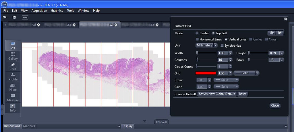 Creating distance measurement gridlines in QuPath - Usage & Issues - Image.sc Forum