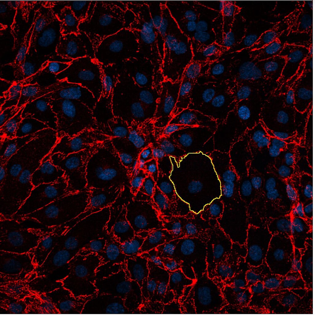 Trying to automize measurements of contionus vs. discontionus junctions in ImageJ. Please help ...