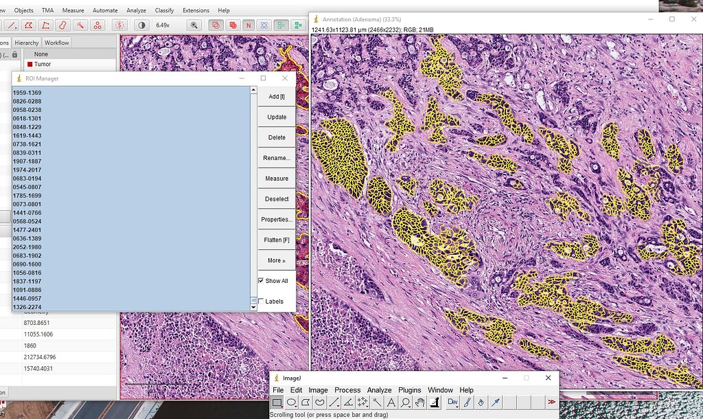Export contour data from ROI manager of ImageJ - Image Analysis - Image.sc Forum