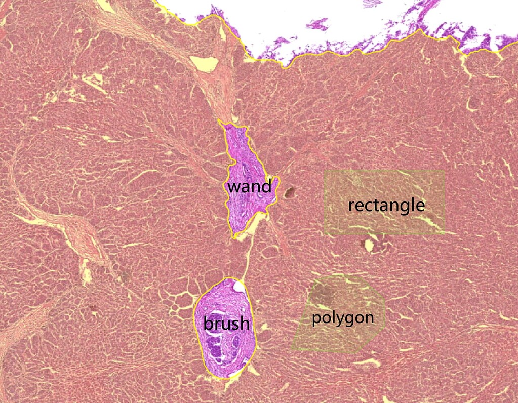 Remove small areas in a big annotation - Usage & Issues - Image.sc Forum