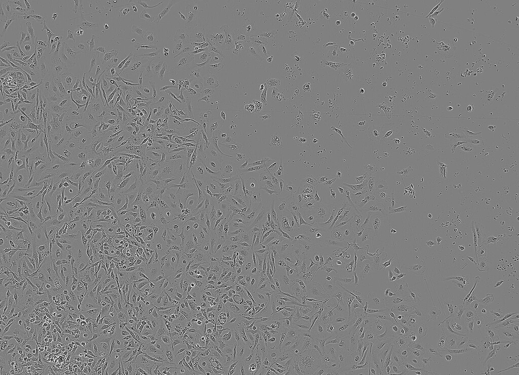 Using ImageJ to count primary microglia - Image Analysis - Image.sc Forum