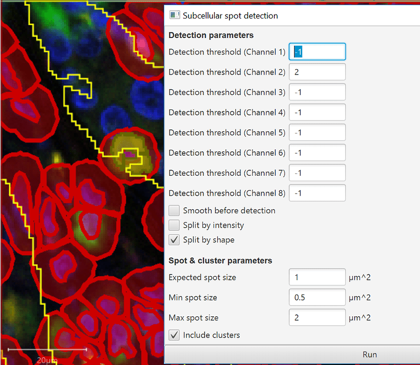 QuPath-Accurate cytoplasmic stain measurements - Image Analysis - Image ...