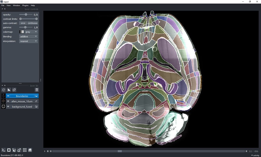 Horizontal registration only saved as coronal - Usage & Issues - Image.sc Forum