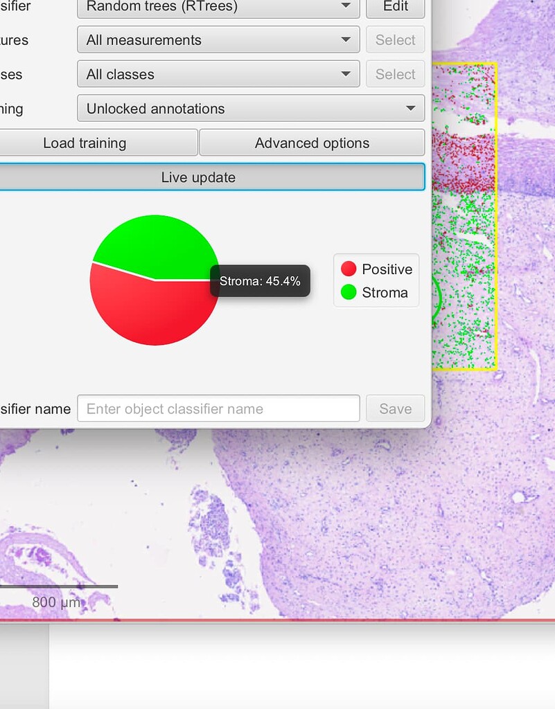 Qupath percentage does not match data? - Image Analysis - Image.sc Forum