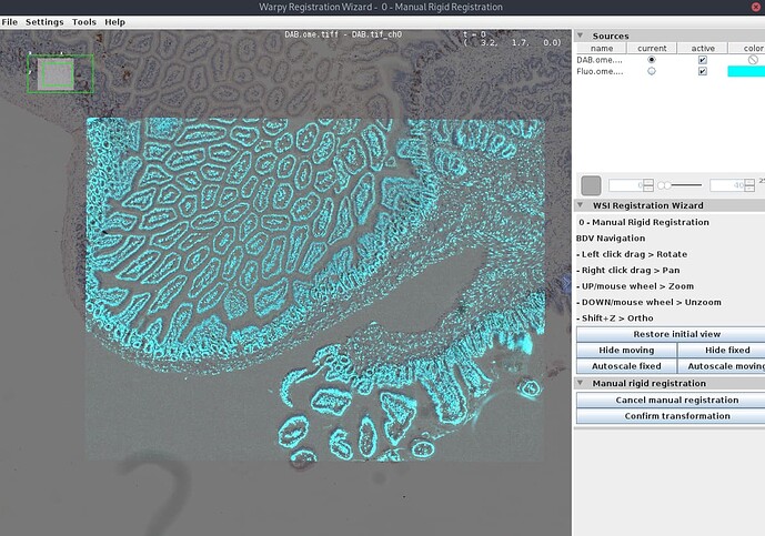 Warpy - Registration of whole slide images at cellular resolution with Fiji and QuPath ...