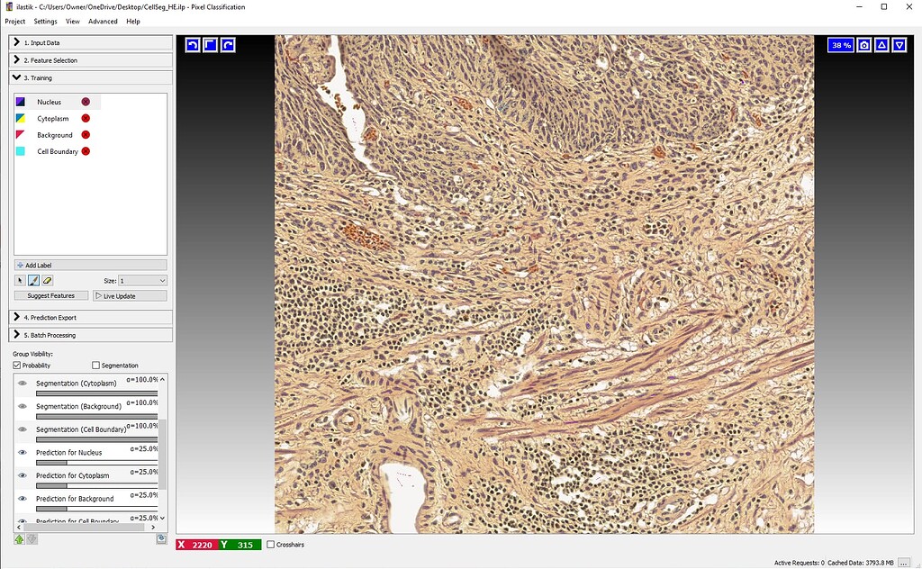 Cell Segmentation in ilastik - Image Analysis - Image.sc Forum