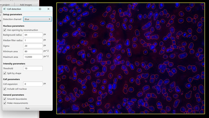 Cell detection in qupath not working across samples - Image Analysis - Image.sc Forum