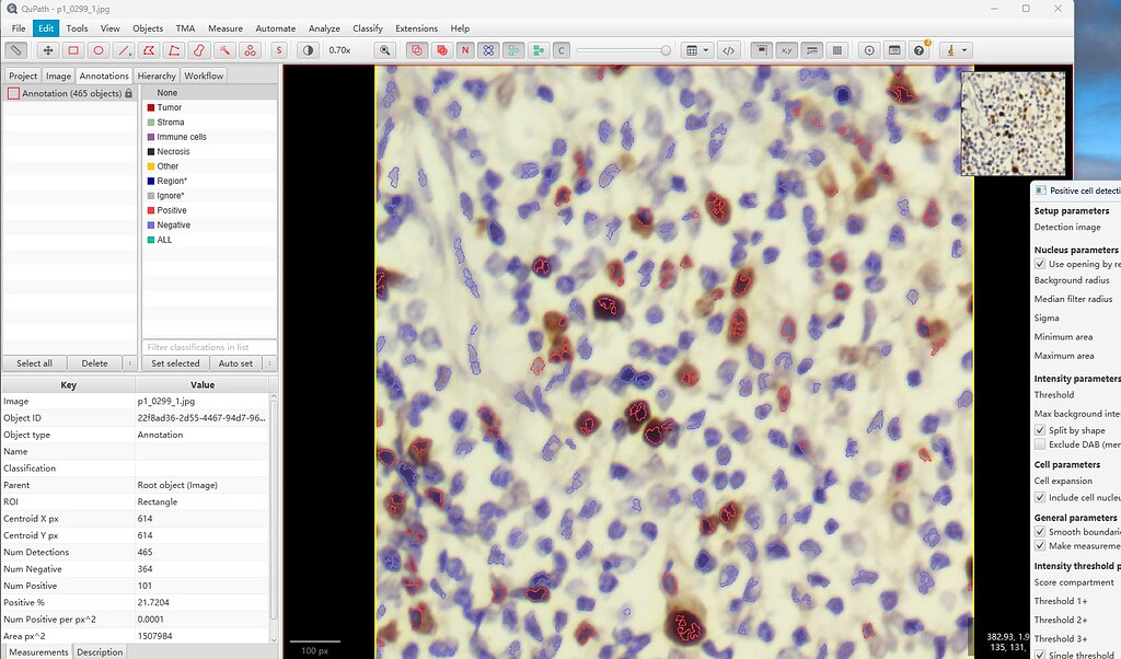 QuPath：cell detection was performed for patches of WSI - Image Analysis - Image.sc Forum