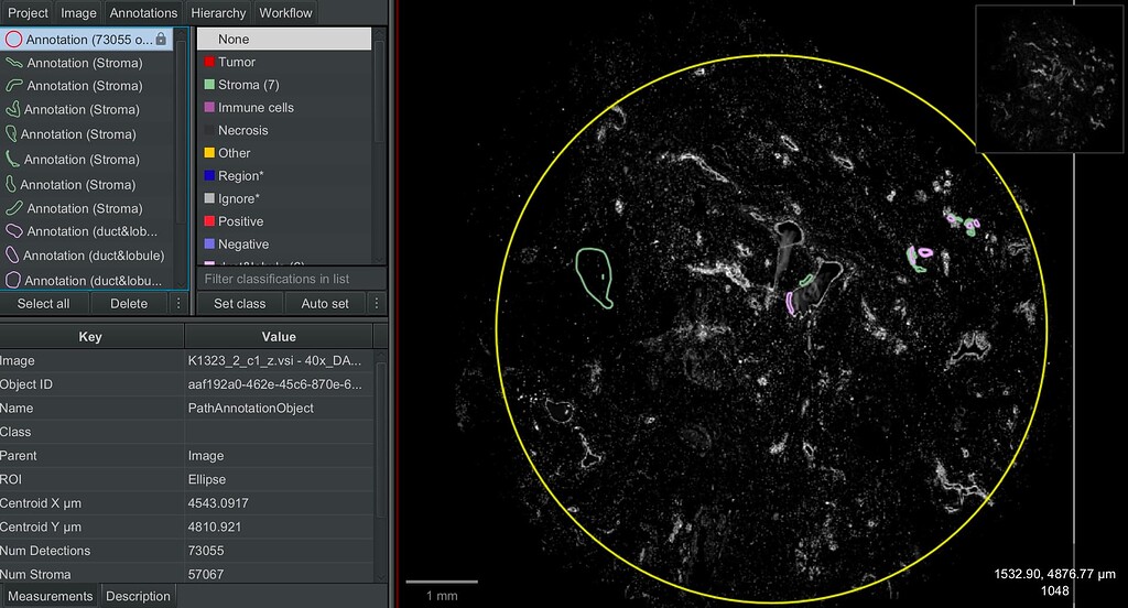 Unable to import annotation files (QuPath; geoJSON) into TissUUmaps 3.1 correctly - Usage ...
