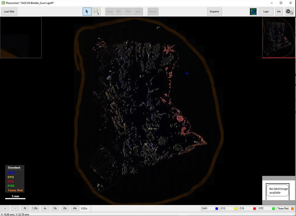 Help needed with pipeline creation for analyzing qptiff WSI images ... Help needed with pipeline creation for analyzing qptiff WSI images ...