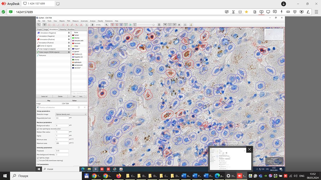 Positive cells detection - Image Analysis - Image.sc Forum