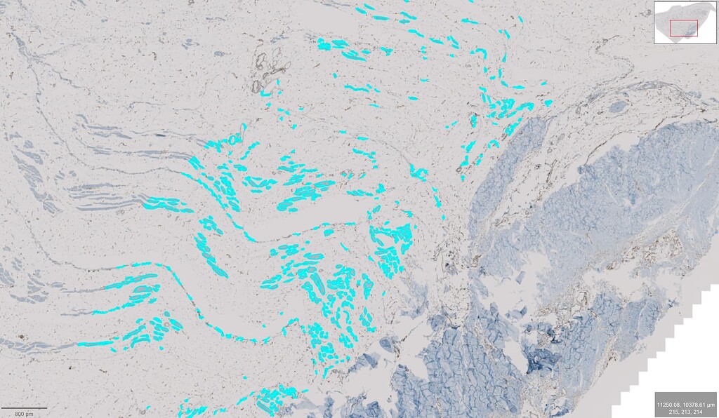 Qupath Script Command To Draw Polygon Annotation From Points Image Analysis Imagesc Forum