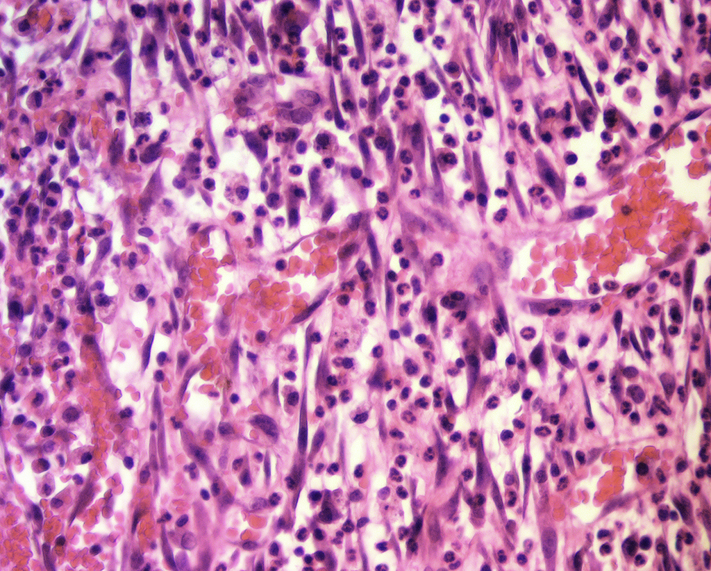 Whole Image Goes Black Using Biovoxxel Background Substract or Any Other Substraction Tools ...