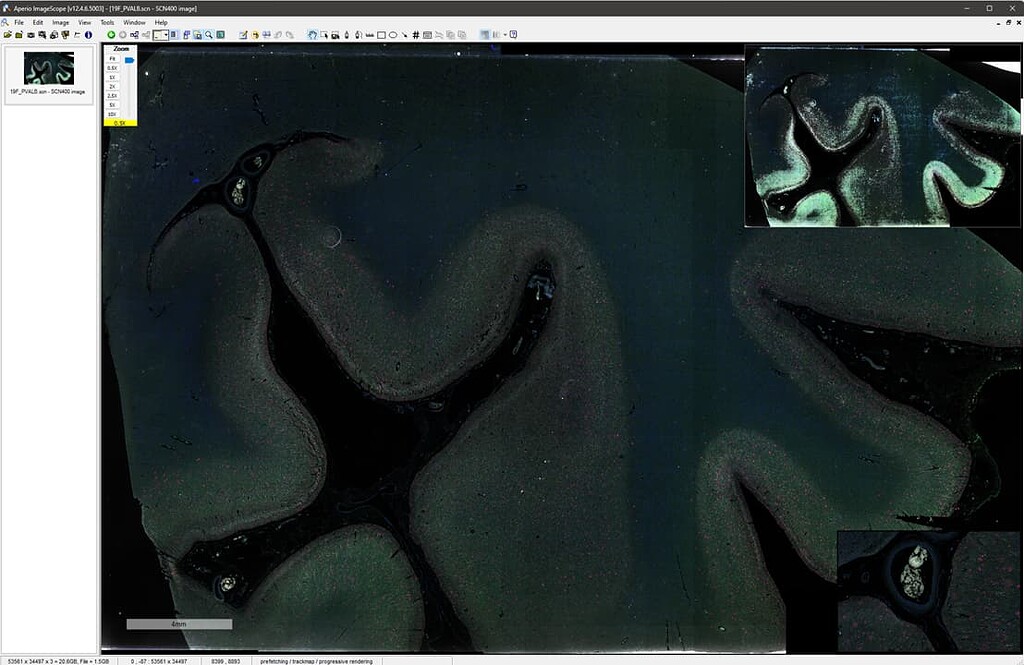 Open Whole Slide Scan As A Single Image In Qupath Usage And Issues Imagesc Forum