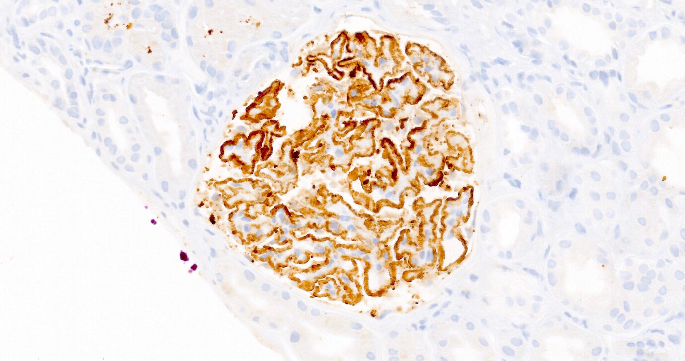 How to measure the area and intensity of IHC staining, as well as ...