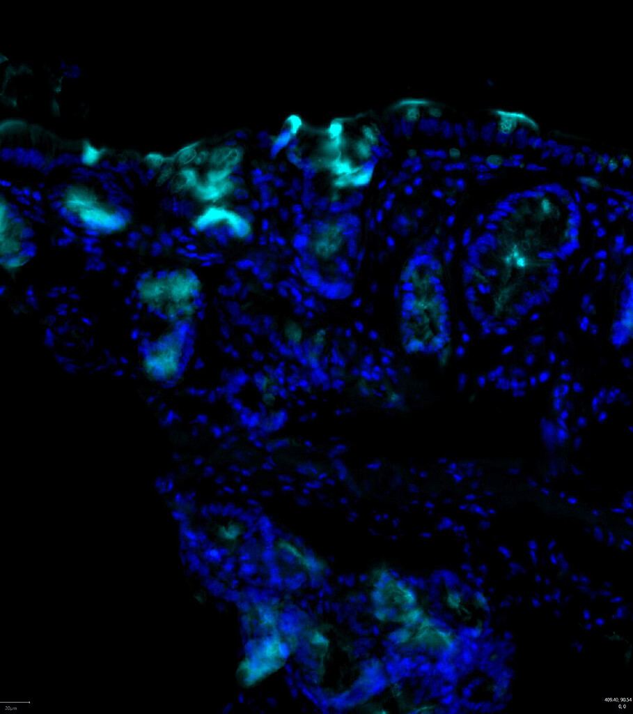 Qupath Pixel Classifier Export Intensity Values Image Analysis Imagesc Forum