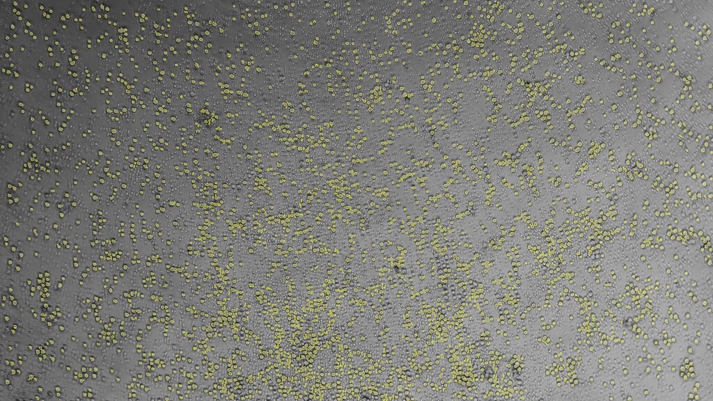 Brightfield cell counting in ImageJ - Image Analysis - Image.sc Forum