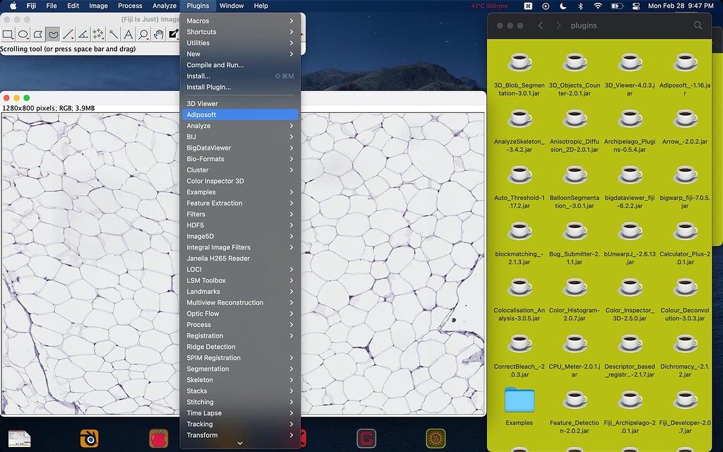 Adiposoft only recognizing some cells - Image Analysis - Image.sc Forum