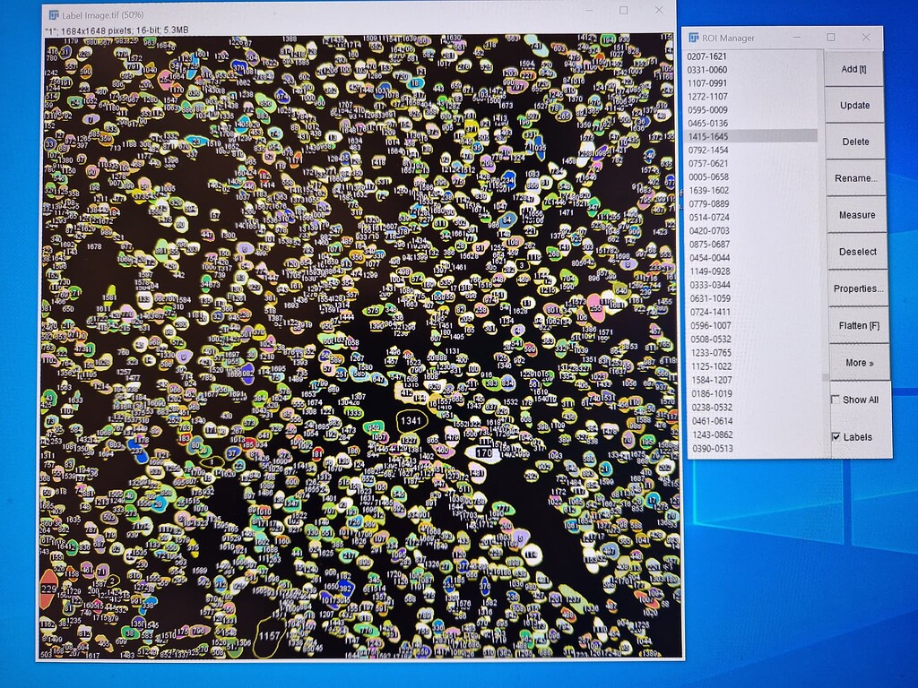 Stardist Python Nuclei Segmentation Image Analysis Image Sc Forum