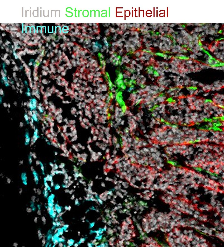 Sequential segmentation in QuPath - Image Analysis - Image.sc Forum