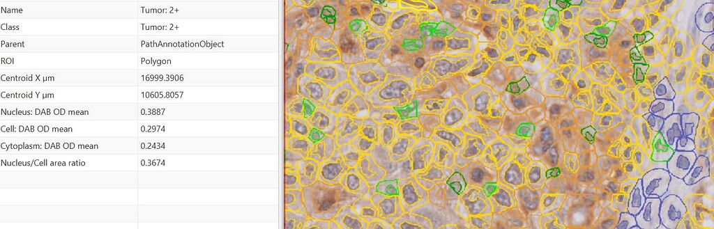 QuPath Cell Segmentation- Membrane, Cytoplasm, Nucleus signal - Image Analysis - Image.sc Forum