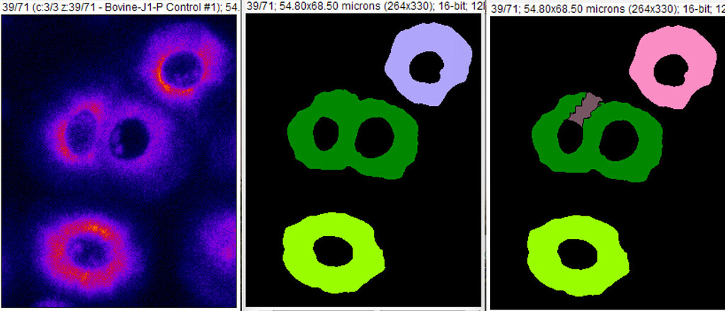 Separating ring-shape objects - 3D segmentation - Image Analysis - Image.sc Forum