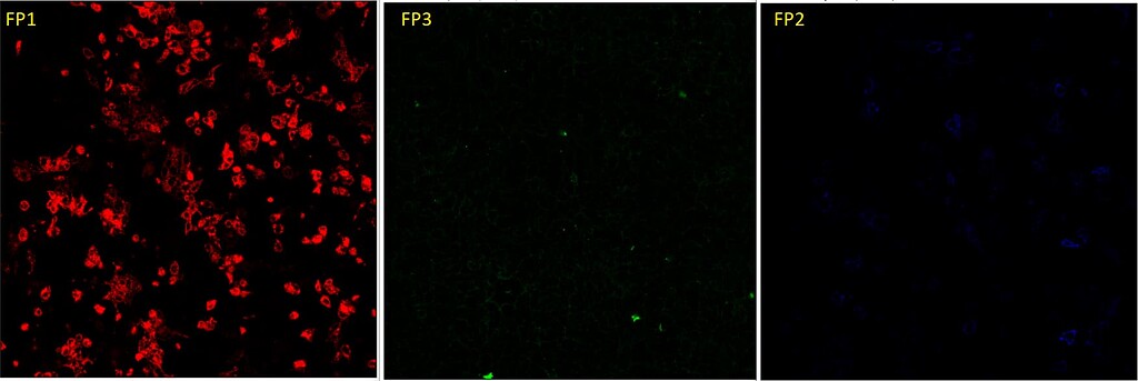 Is Gaussian-Blur and Thresholding good for counting cells? - Image Analysis - Image.sc Forum