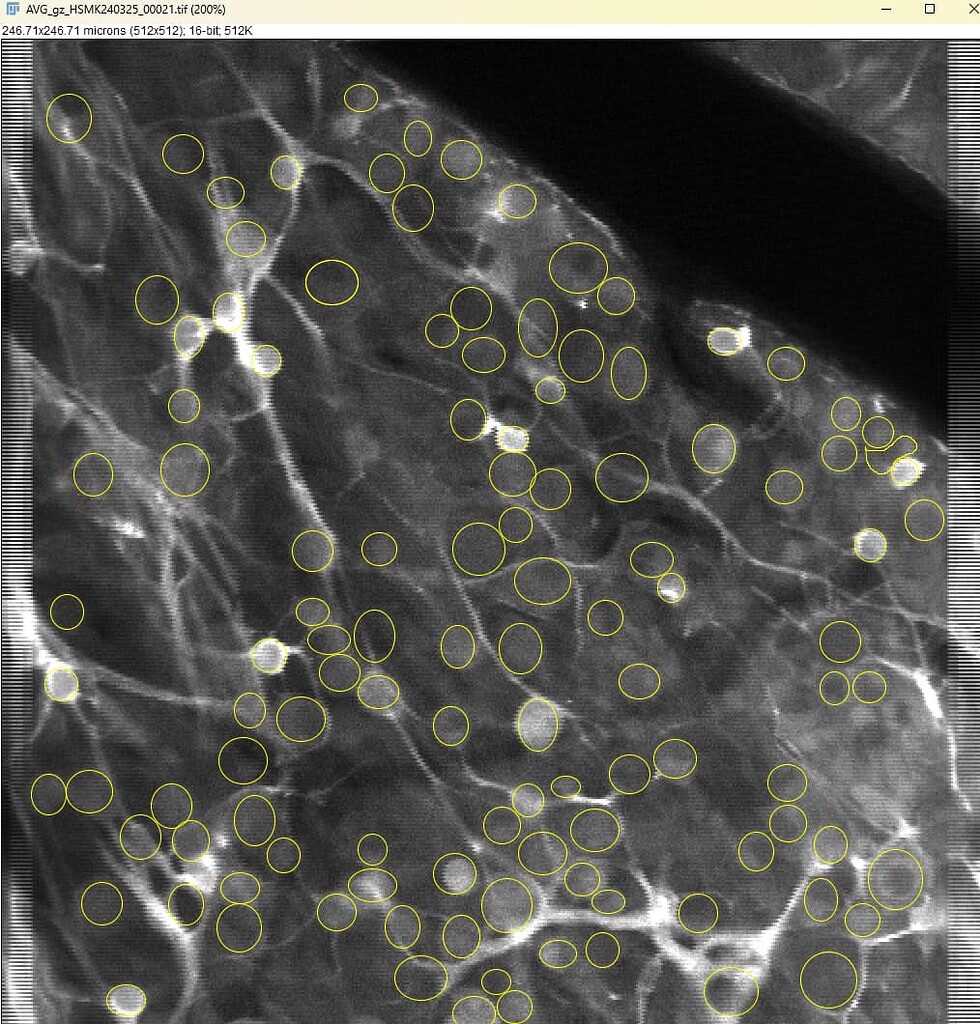 Importing ImageJ ROIs into Cellpose - Image Analysis - Image.sc Forum