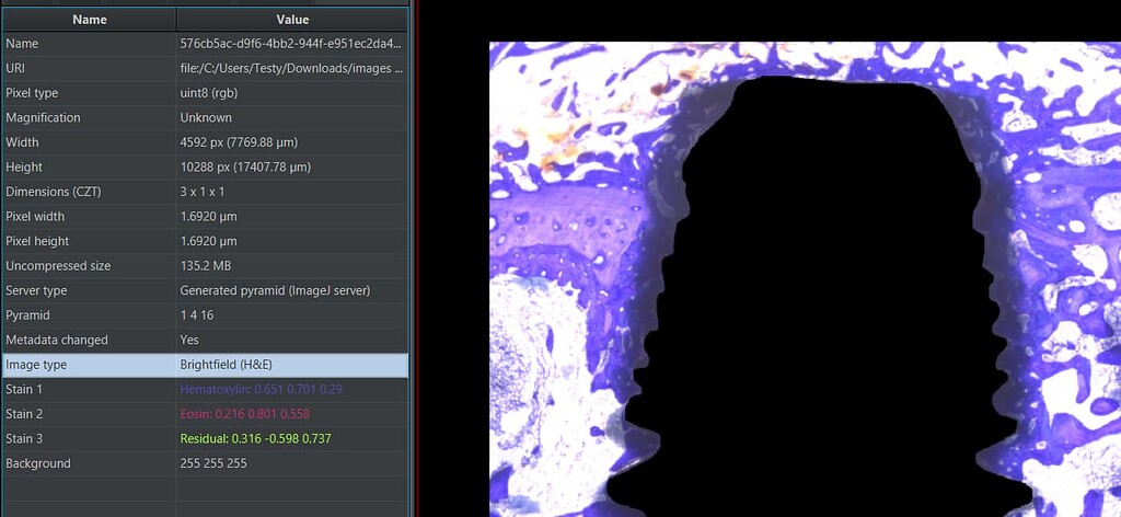 Toluidine Blue Deconvolution - Usage & Issues - Image.sc Forum