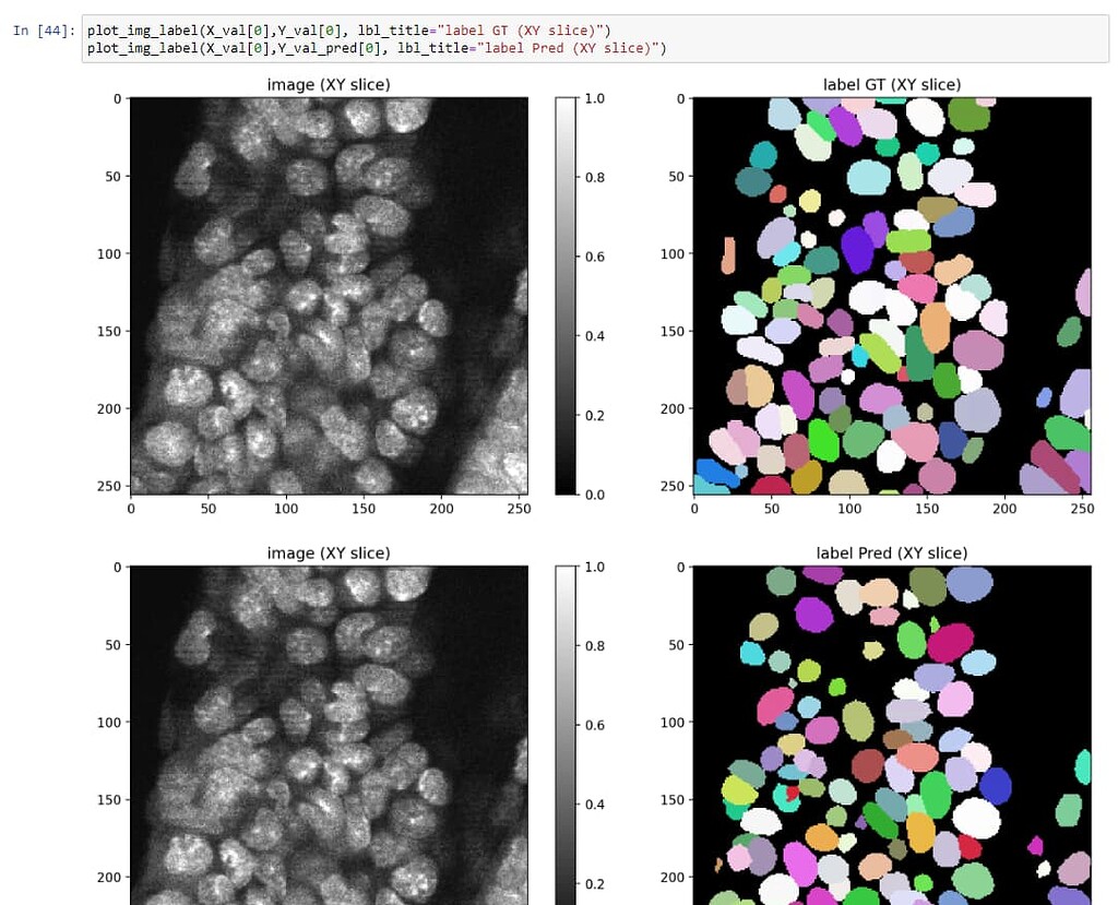 StarDist 3D null results - Usage & Issues - Image.sc Forum