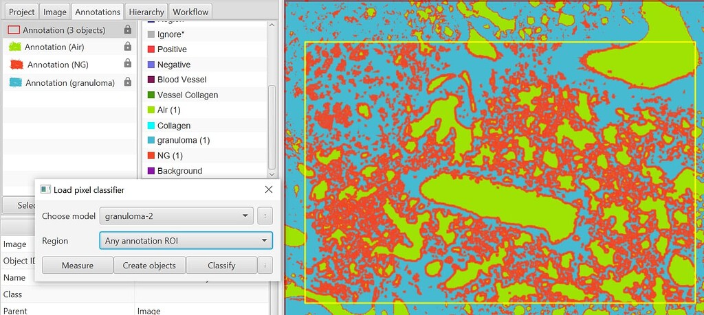 Qupath Error In Creating Objects From Pixel Classification Usage And Issues Image Sc Forum