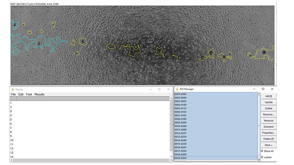 How to use Wound_healing_size_tool - Image Analysis - Image.sc Forum